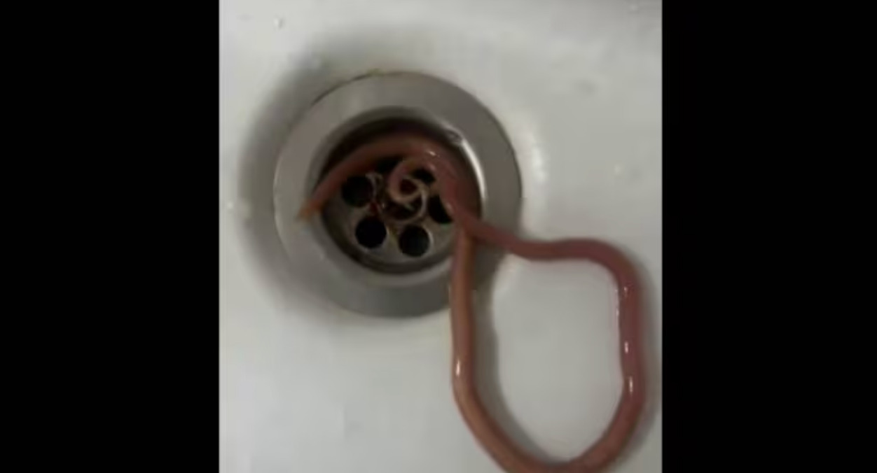 Not for faint hearted!!! Man vomits wriggling worm! Video